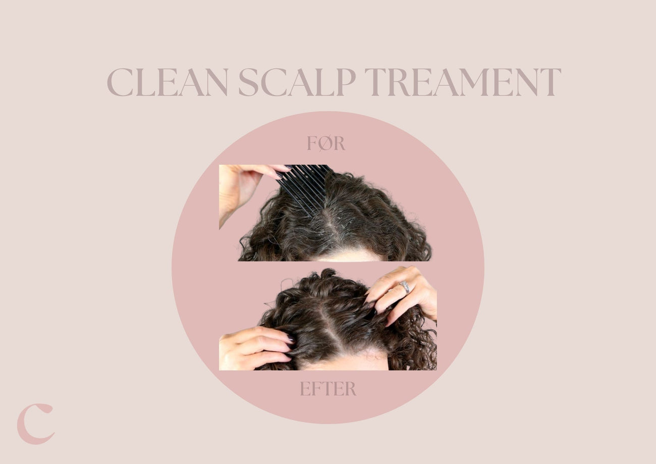 Clean Scalp Treatment: Vejen til en sundere hovedbund og smukkere hår ...